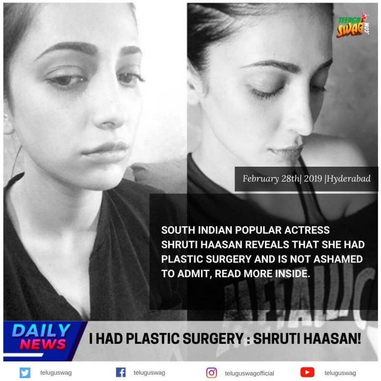 i had plastic surgery : Shruti Haasan! | Telugu Swag