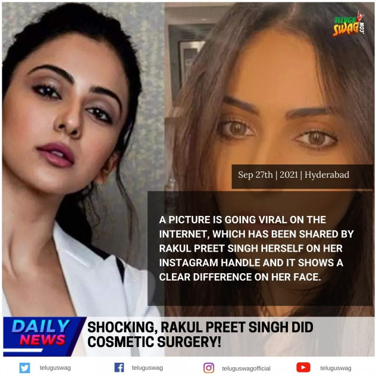 shocking, Rakul Preet Singh did cosmetic surgery! | Telugu Swag